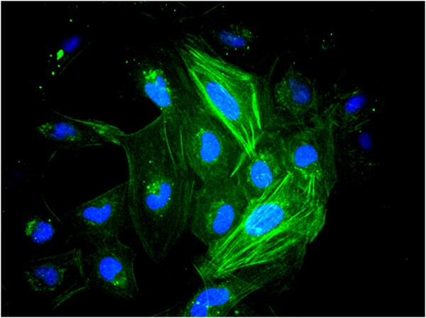 LX-2 Human Hepatic Stellate Cell Line | SCC064